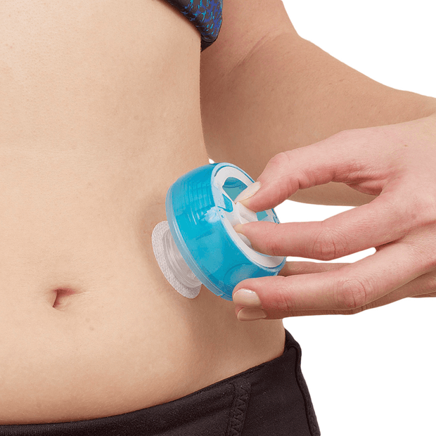 Medtronic iPort Advance Cannula | Injection Port | Diabetes Shop